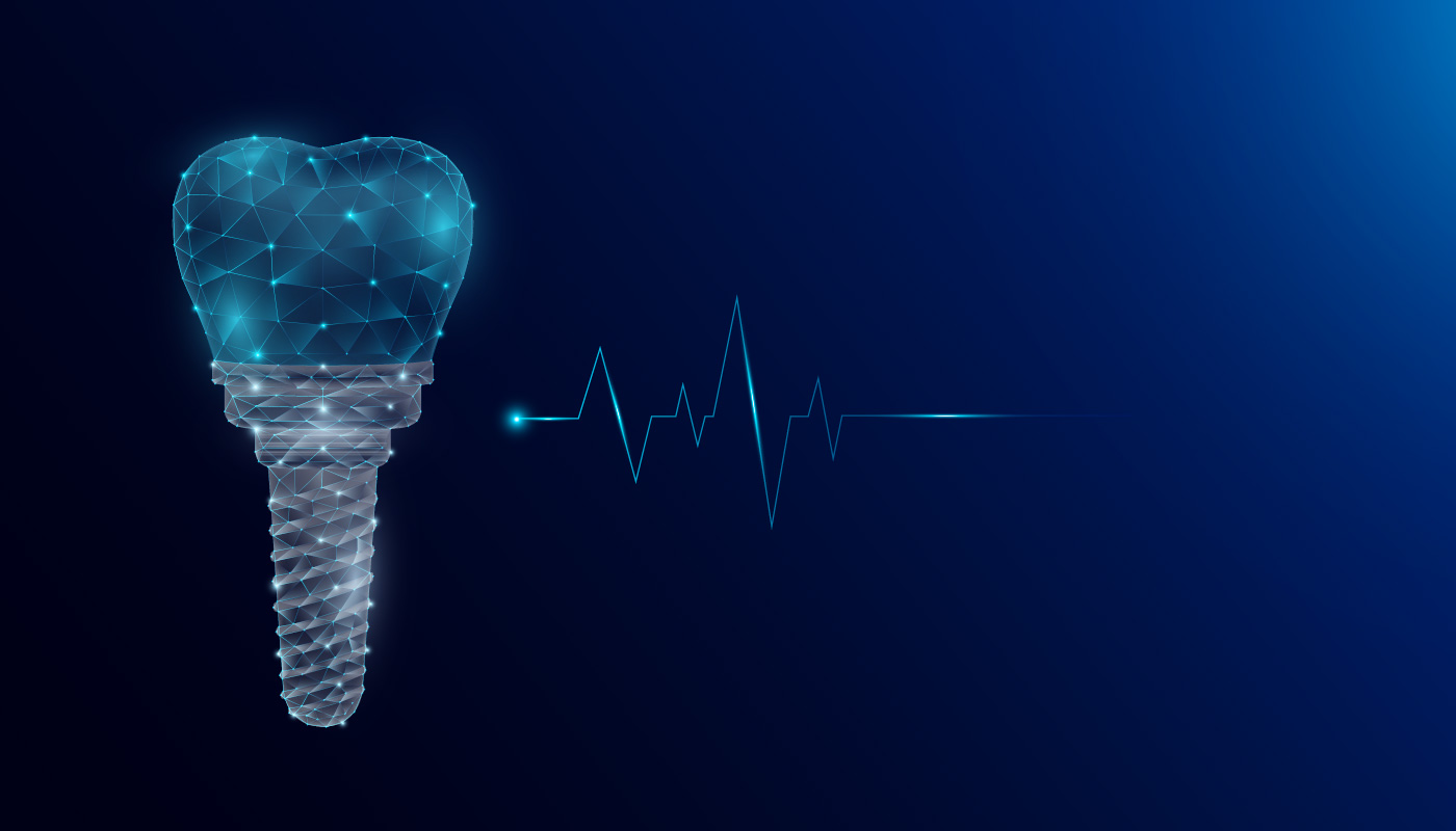 Digital Dental Implants: Precision, Comfort, and Confidence in Modern ...